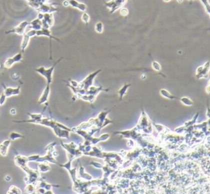 SH-SY5Y 人神经母细胞瘤细胞（STR鉴定正确）_人源细胞系_细胞株_产品中心_南京翼飞雪生物科技有限公司